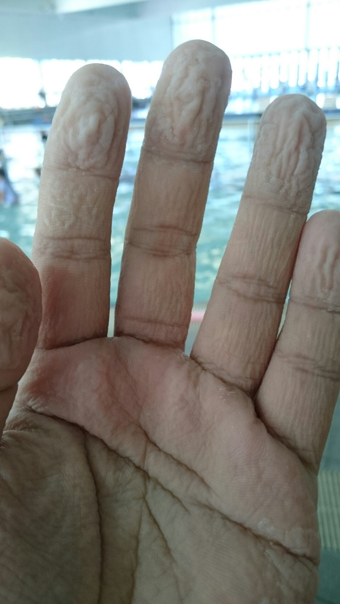 The truth behind wet wrinkly fingers. – The Fish Vet's Blog